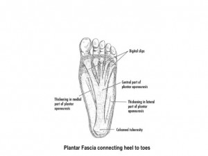 Plantar Fasciitis by Dr Kathleen Thompson | Frost Magazine